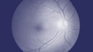 #30: ASHA Therapeutics' Approach to Slowing and Partially Reversing ...